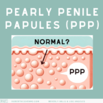 Bumps on your penis? Understanding Pearly Penile Papules (PPP) - Robert ...